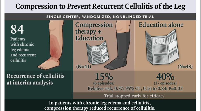 HEALTH: “COMPRESSION THERAPY” REDUCES CHRONIC CELLULITIS & LEG EDEMA ...