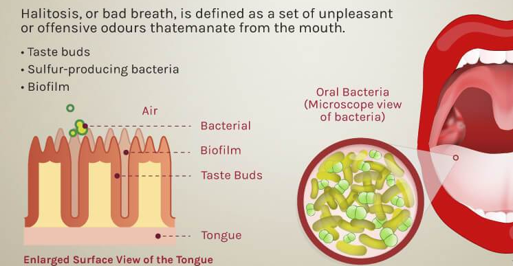 THE DOCTORS 101 CHRONIC SYMPTOMS & CONDITIONS #17: BAD BREATH ...
