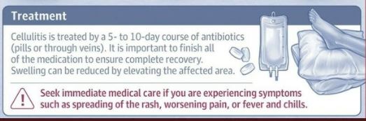 INFOGRAPHICS: ‘CELLULITIS’ – ITS CAUSE & TREATMENT | Doctors Without ...