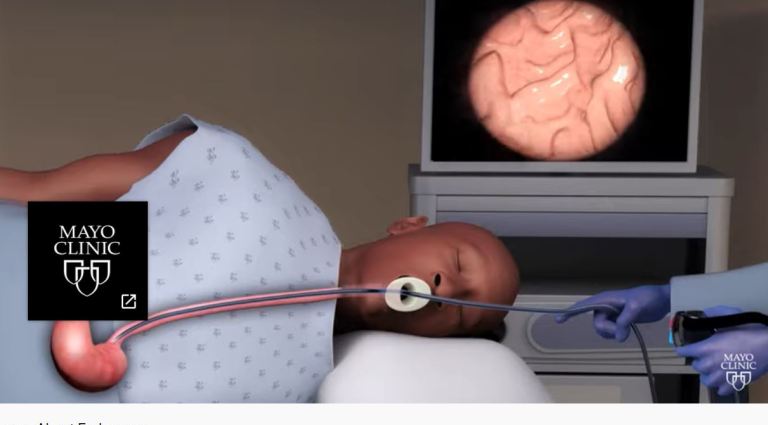 Procedures: Endoscopy Of Stomach & Intestine | Doctors Without Waiting ...