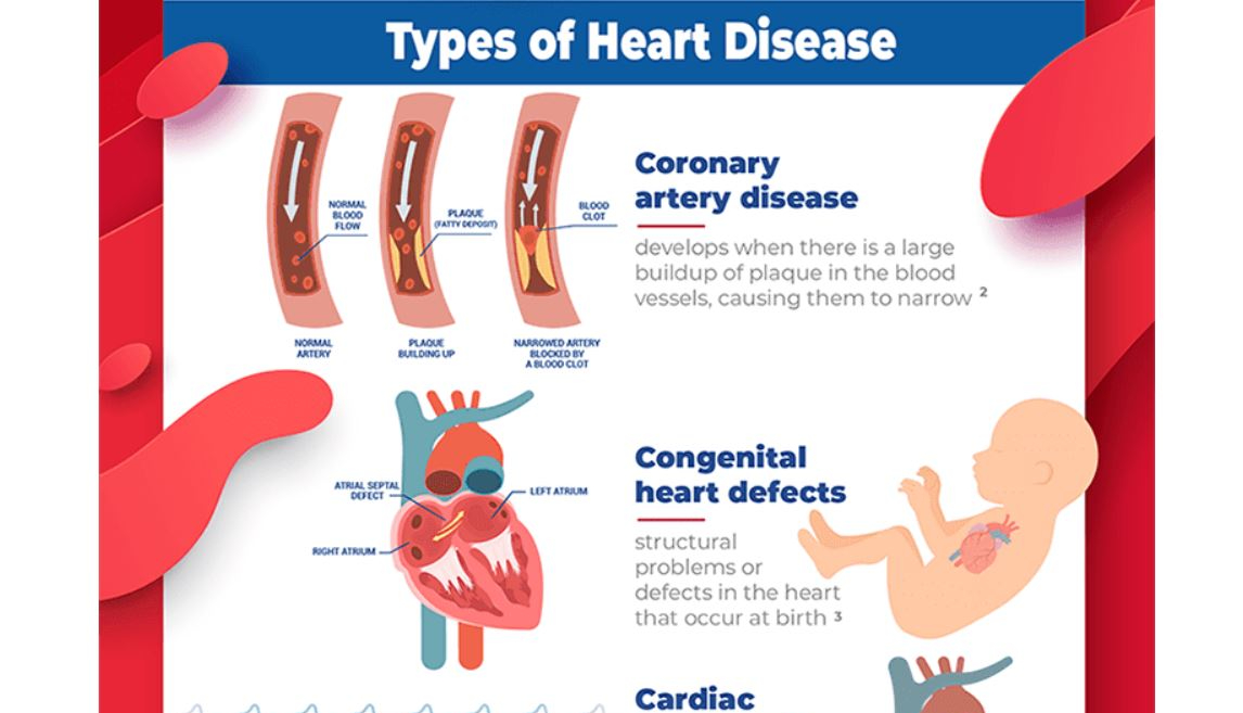 Infographic On The Difference Between Heart Failure And A