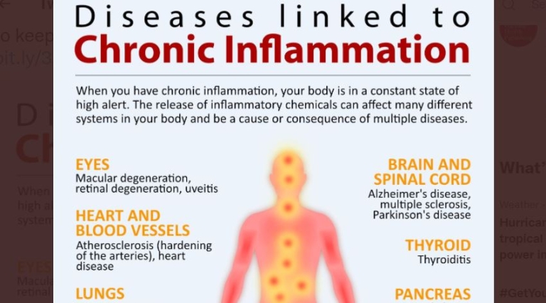 INFOGRAPHIC: DISEASE & CHRONIC INFLAMMATION | Doctors Without Waiting Rooms