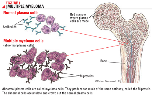 DR. C’S JOURNAL: WHAT IS MULTIPLE MYELOMA? | Doctors Without Waiting Rooms