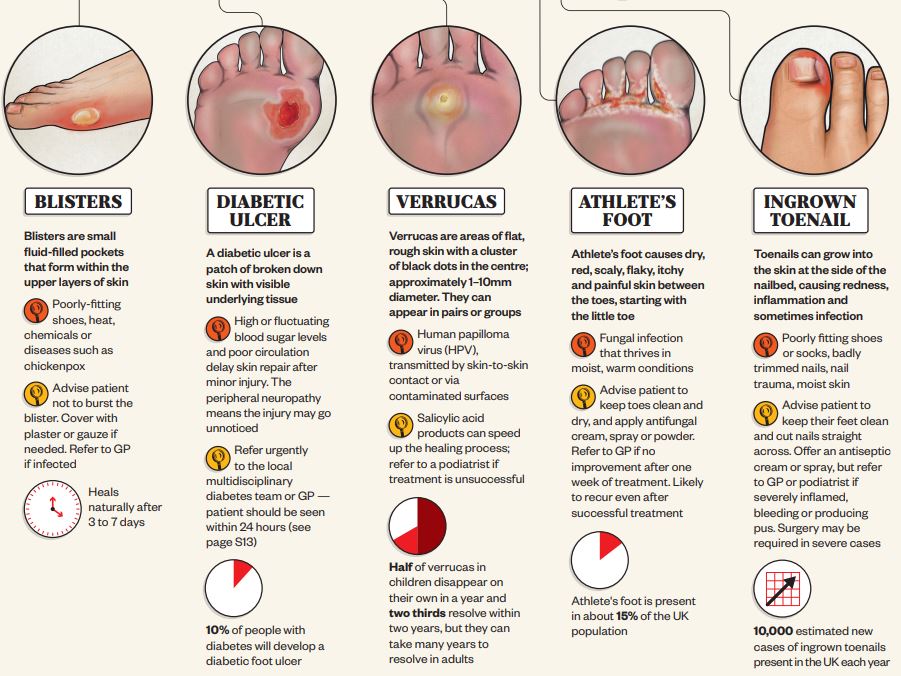 DR. C’S JOURNAL: SOME TIPS FOR CARE OF THE FEET | Doctors Without ...