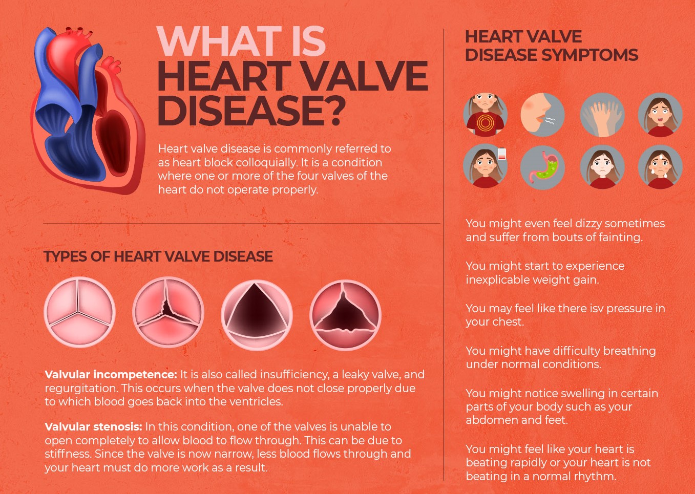 DR. C’S JOURNAL: WHAT IS VALVULAR HEART DISEASE? | Doctors Without ...
