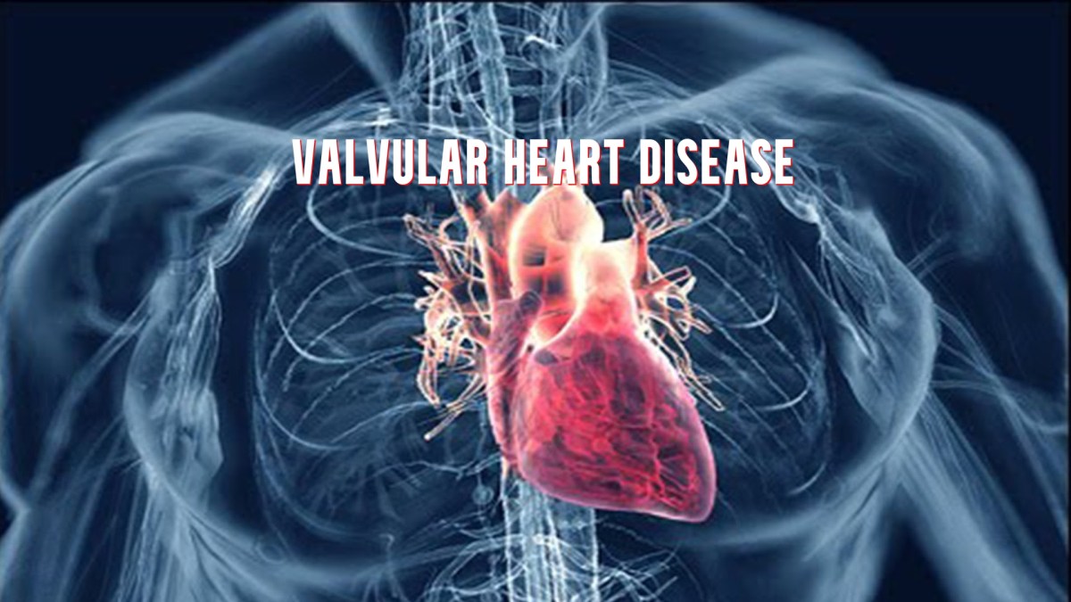DR. C’S JOURNAL: WHAT IS VALVULAR HEART DISEASE? | Doctors Without ...