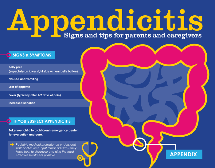 DR. C’S JOURNAL: SIGNS AND SYMPTOMS OF APPENDICITIS | Doctors Without ...