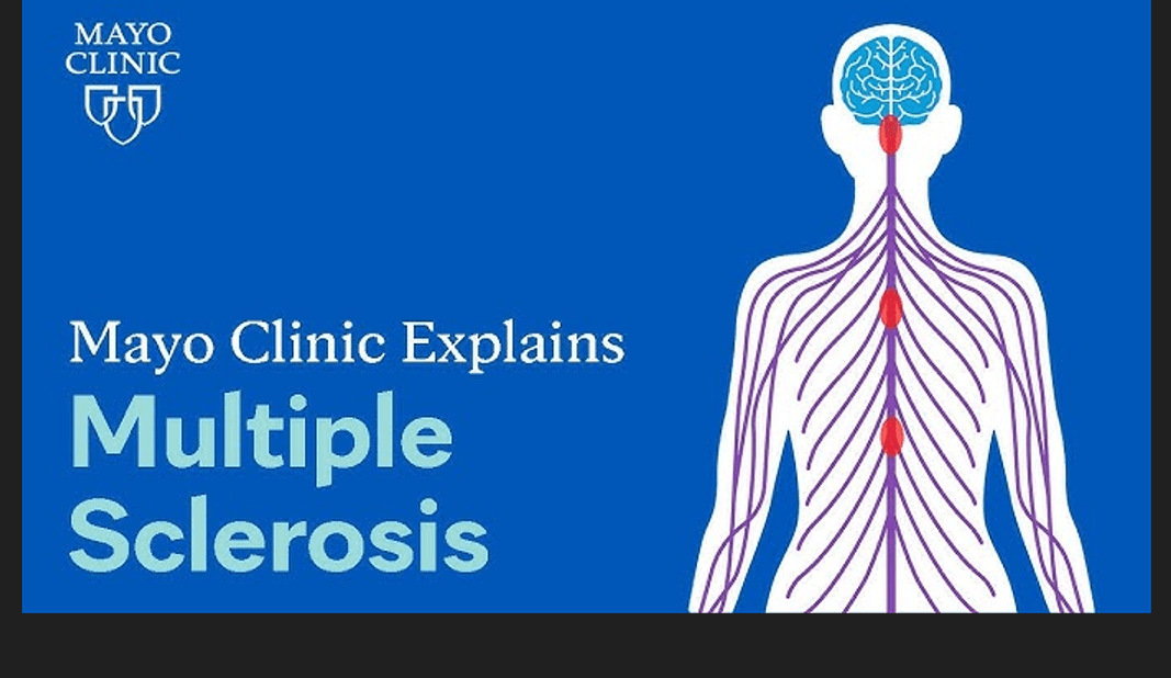 Nervous System: Multiple Sclerosis Explained (Mayo) | Doctors Without ...