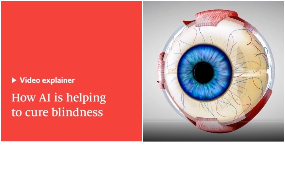 Technology: How AI Is Helping To Cure Blindness | Doctors Without ...