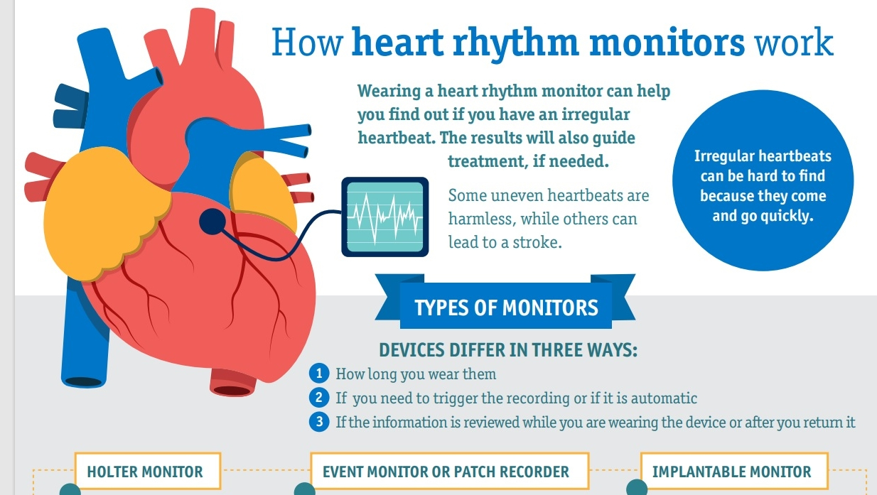 Infographic: How Heart Rhythm Monitors Work | Doctors Without Waiting Rooms