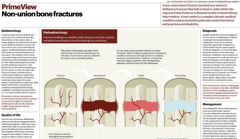Chronic Conditions: Non-Union Bone Fractures | Doctors Without Waiting ...