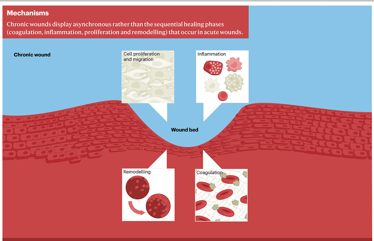 Infographics: Chronic Wounds In Older Adults | Doctors Without Waiting ...