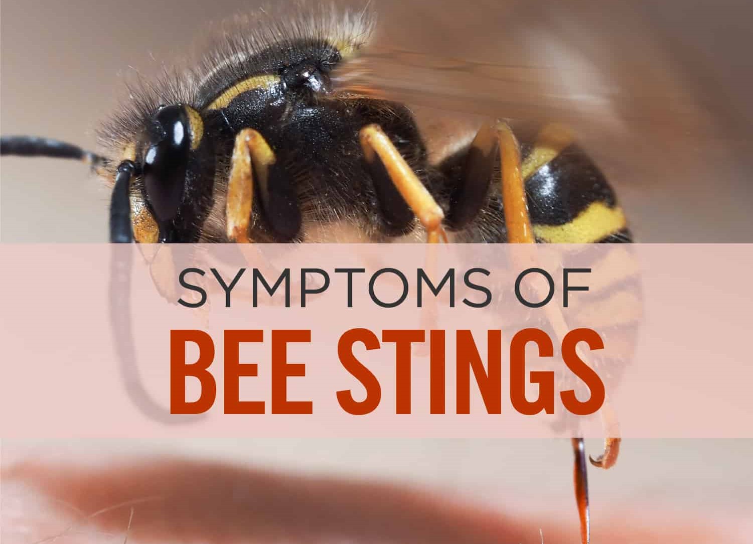 Dr. C’s Journal: Bee Sting Allergies And Reactions | Doctors Without ...