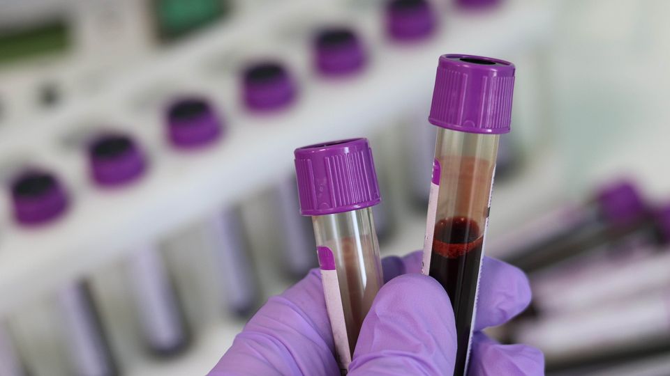 RESEARCH: ‘SINGLE DROP’ BLOOD TESTING ADVANCES | Doctors Without ...