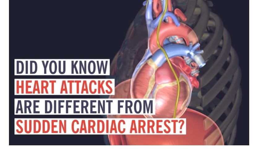 Reviews: Heart Attacks Vs. Sudden Cardiac Arrest | Doctors Without ...