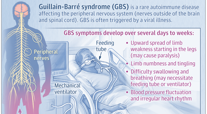 Auto-Immune Diseases: Guillain-Barré Syndrome | Doctors Without Waiting ...