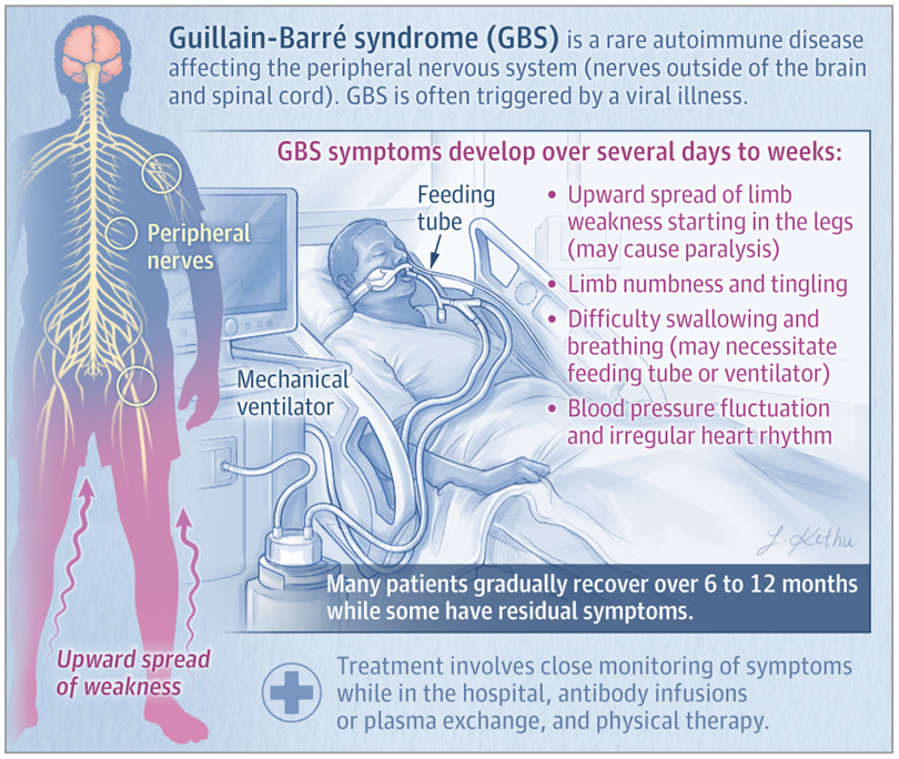 Auto-Immune Diseases: Guillain-Barré Syndrome | Doctors Without Waiting ...