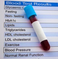 Cholesterol: How To Read The Lipid Panel Blood Test | Doctors Without ...