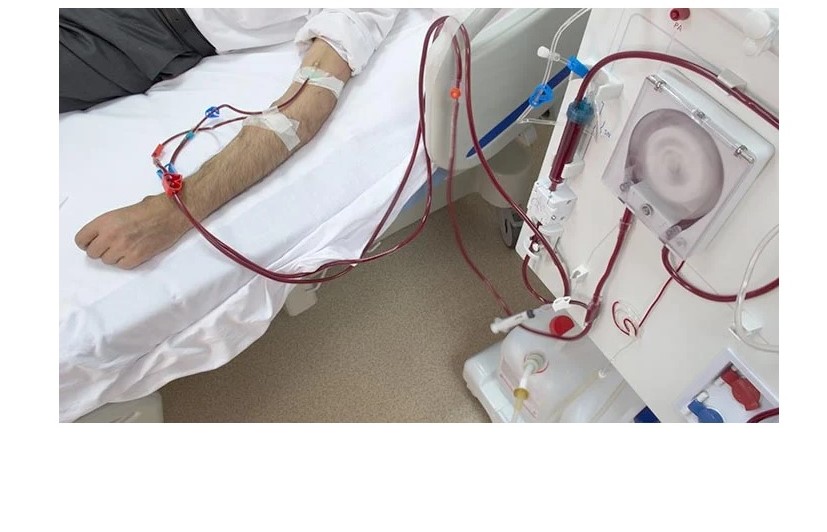 Kidney Failure Reviews: The History Of Dialysis | Doctors Without ...