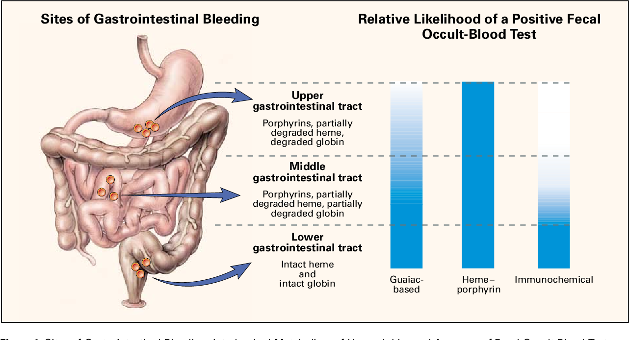 Review: Gastrointestinal Bleeding Management | Doctors Without Waiting ...